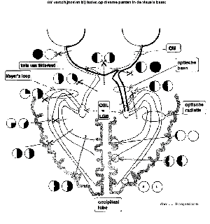Anatomische samenhang van gezichtsvelddeffecten.